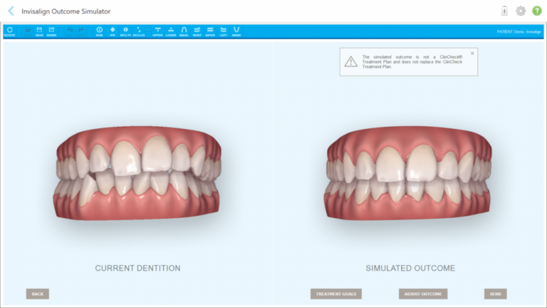 Orthodontic Simulation Software – Bible Hill Family Dentistry
